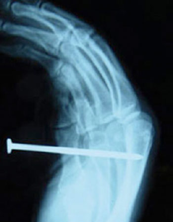 Safety Tip of the Week – Nailing Down the Need for Nail Gun Safety ...