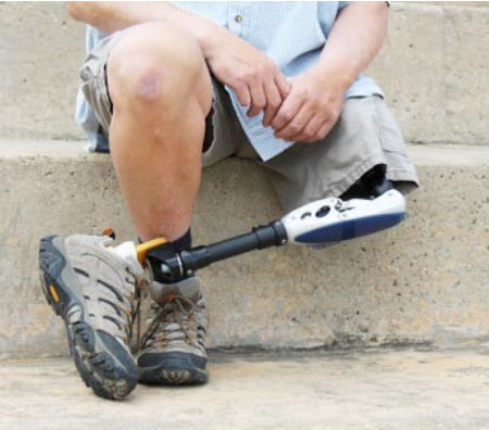 Safety Tip of the Week – Amputation Hazards – Safety Matters Weekly